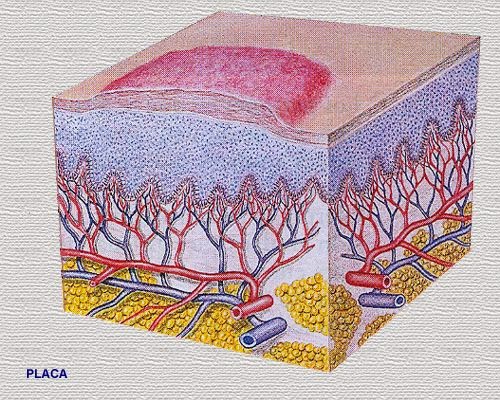 Dermatología y más cosas: LESIONES CUTÁNEAS EN PACIENTES INGRESADOS ...