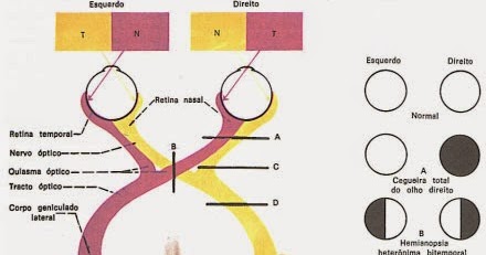 Ecociencia: Resumen vías visuales y tipos de ceguera (tercero medio)