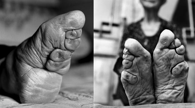 Kaki Lotus, Tradisi Aneh Wanita di China - DringkingVora