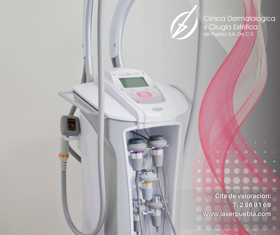 Nuevo LipoMax RF en Clínica Láser Puebla, seis Tecnologías que tratan ...