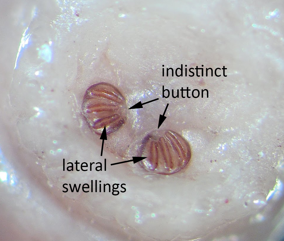 Creepy Dreadful Wonderful Parasites: Answer to Case 501