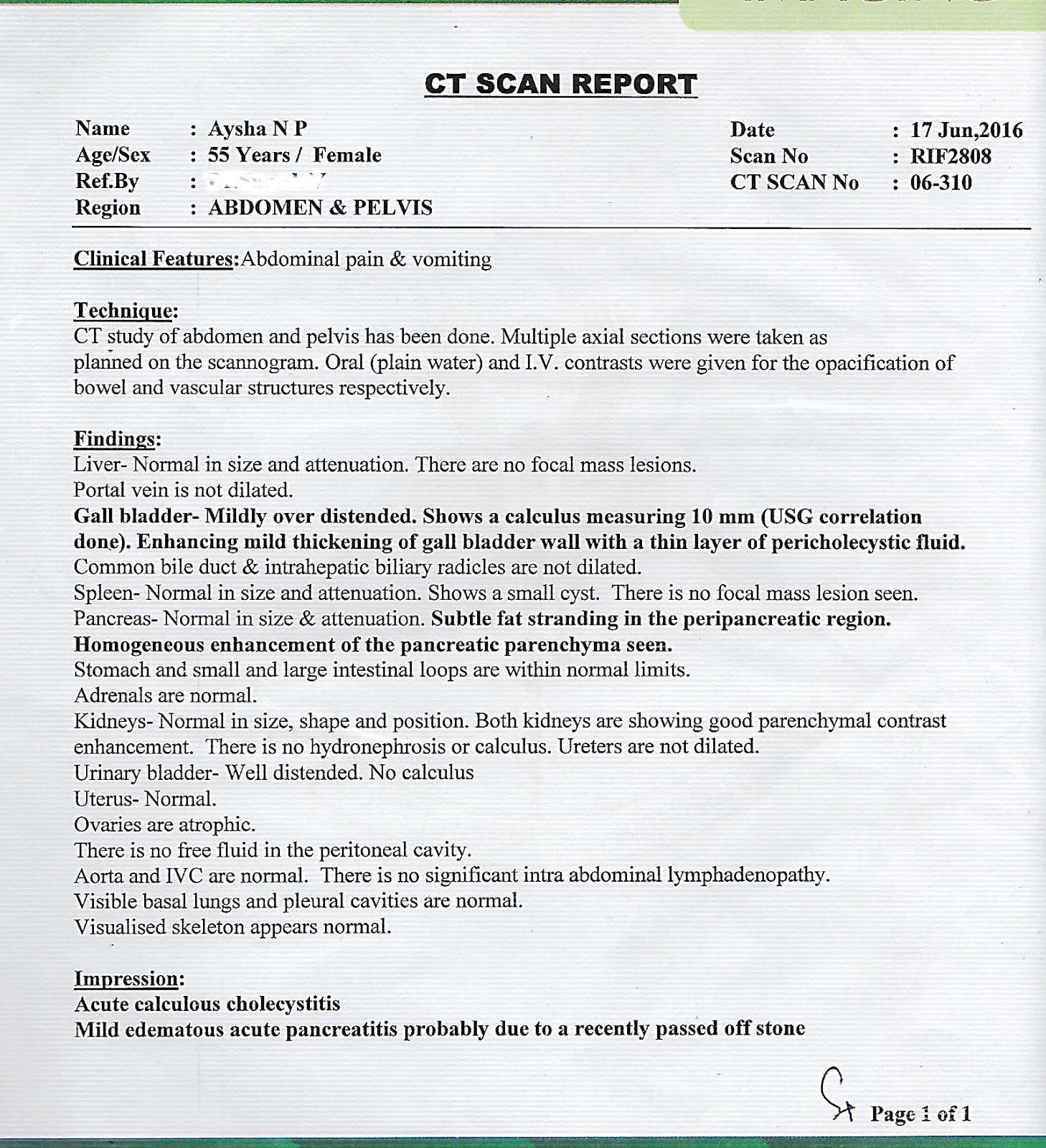 Dr.Akbar homeopathy: GALL BLADDER CALCULUS