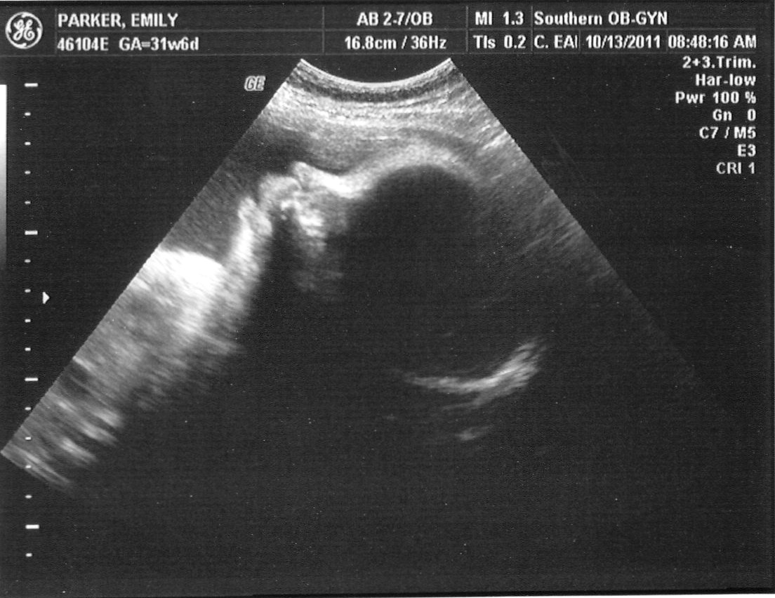 32 Week OBGYN Visit ~ Last Ultrasound! - The Journey of Parenthood...