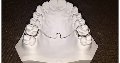 Ortho Lab Solution: Transpalatal Arch (TPA)