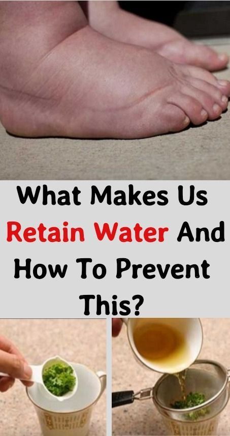 What Makes Us Retain Water And How To Prevent This? - Theraphy 2
