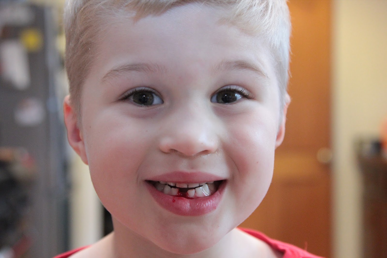 The Poco Loco Olsons: Conor Lost His First Tooth