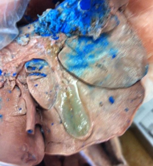 Biology Pig Dissection: Gr 11 Fetal Pig Dissection