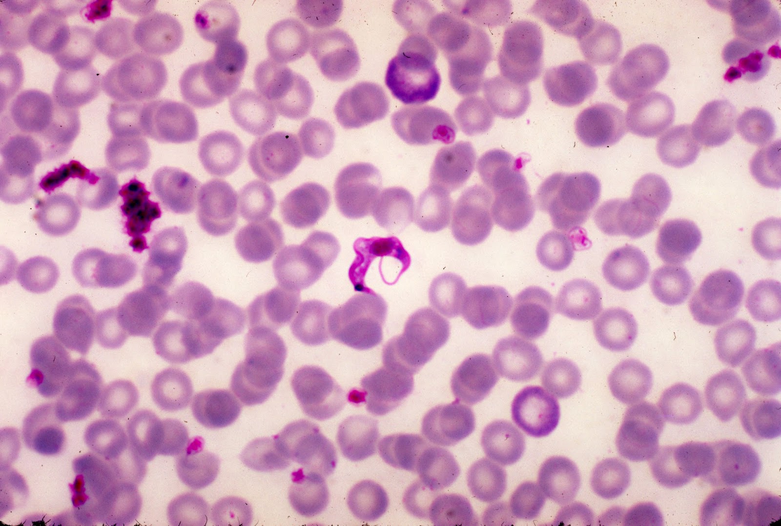 NCSU PDIC: Kissing Bugs and Chagas Disease in NC