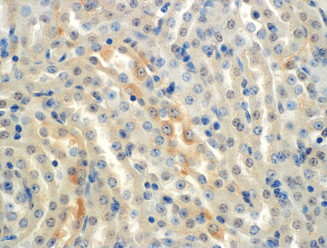 Immunostaining: Main factors of Tissue Sectioning