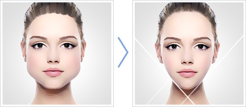 Berbagai macam prosedur tanpa operasi untuk membentuk wajah tirus /V-shaped