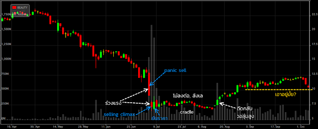 รูปแบบแท่งเทียนหยุดลงชั่วคราว : Cradle Pattern