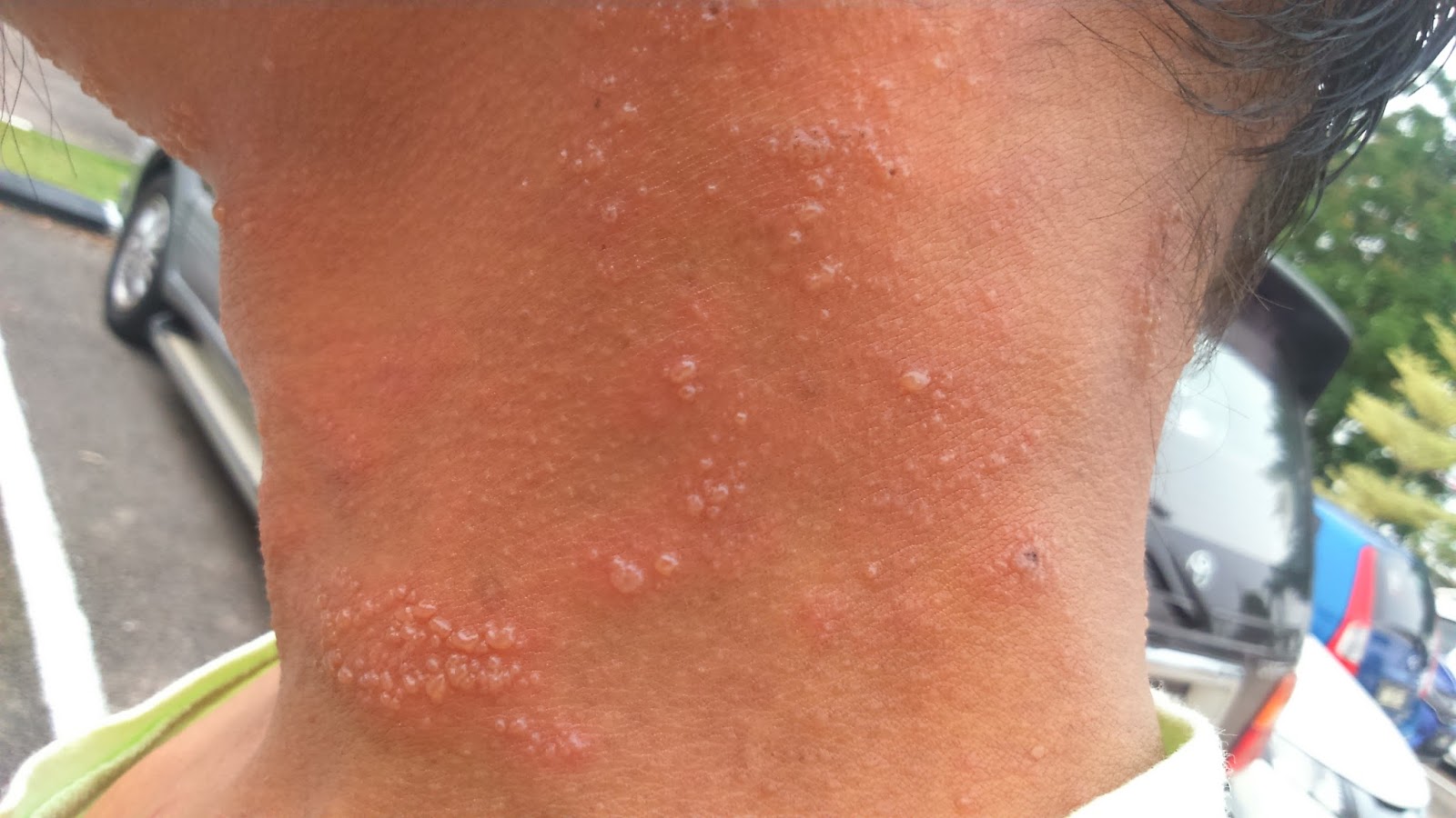 ini belog saya yang punya : KAYAP MENYERANG ORANG KESAYANGAN KITA