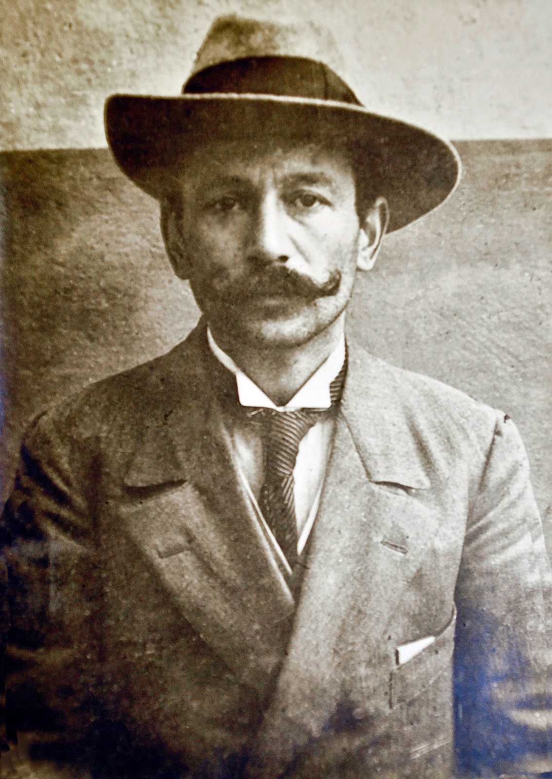 Bombilla Tapada: Falsos positivos, falso crup, falsa escuadra, falso post