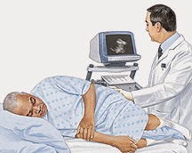 Biopsia de Prostata: Como se realiza una biopsia de prostata