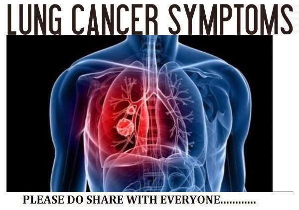 THE GRAPEVINE UPDATED: 9 EARLY SIGNS OF LUNG CANCER