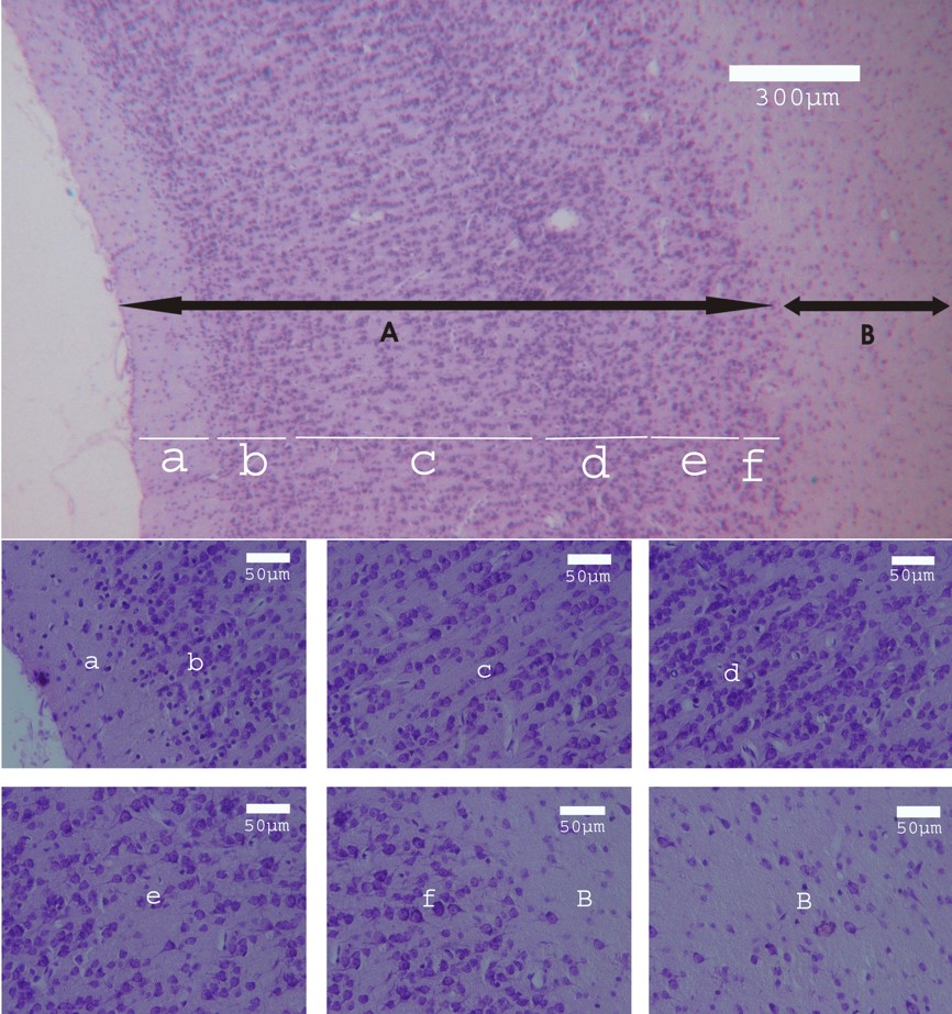 HISTOLOGI NEOKORTEKS MELALUI PEWARNAAN CRESYL ECHT VIOLET