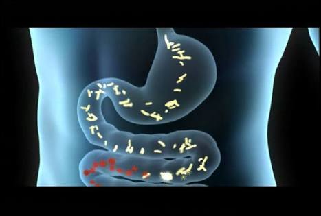 Lactobacillus casei Shirota