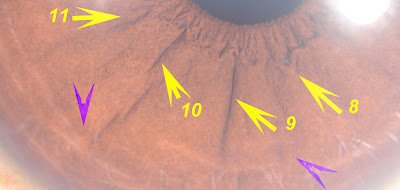 Modern & Multidimensional Iridology: Classical & Holistic Iridology ...