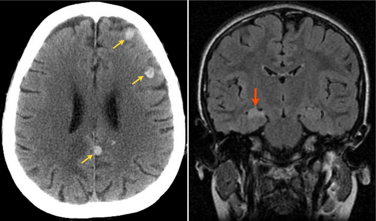 HEALTH FROM TRUSTED SOURCES: Brain : CT MRI
