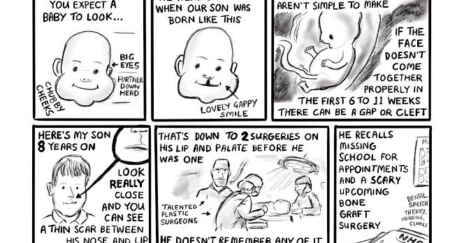 Cartoons I Drew: Cleft Awareness Week 2017