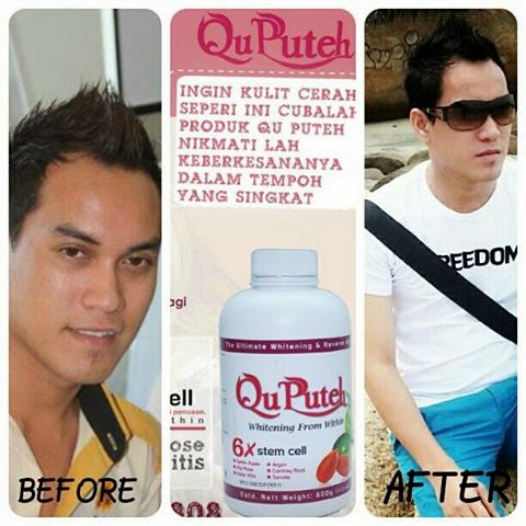 AKIRASOYANISH World: QU PUTEH 6X STEM CELL : VIDA BEAUTY