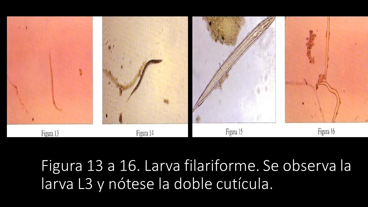 Microbiología: UNCINARIAS/ NECATOR AMERICANUS