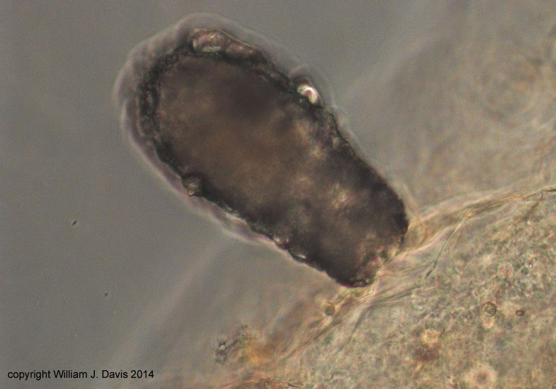 Wandering Naturalist: Protist Love 1--Difflugia!