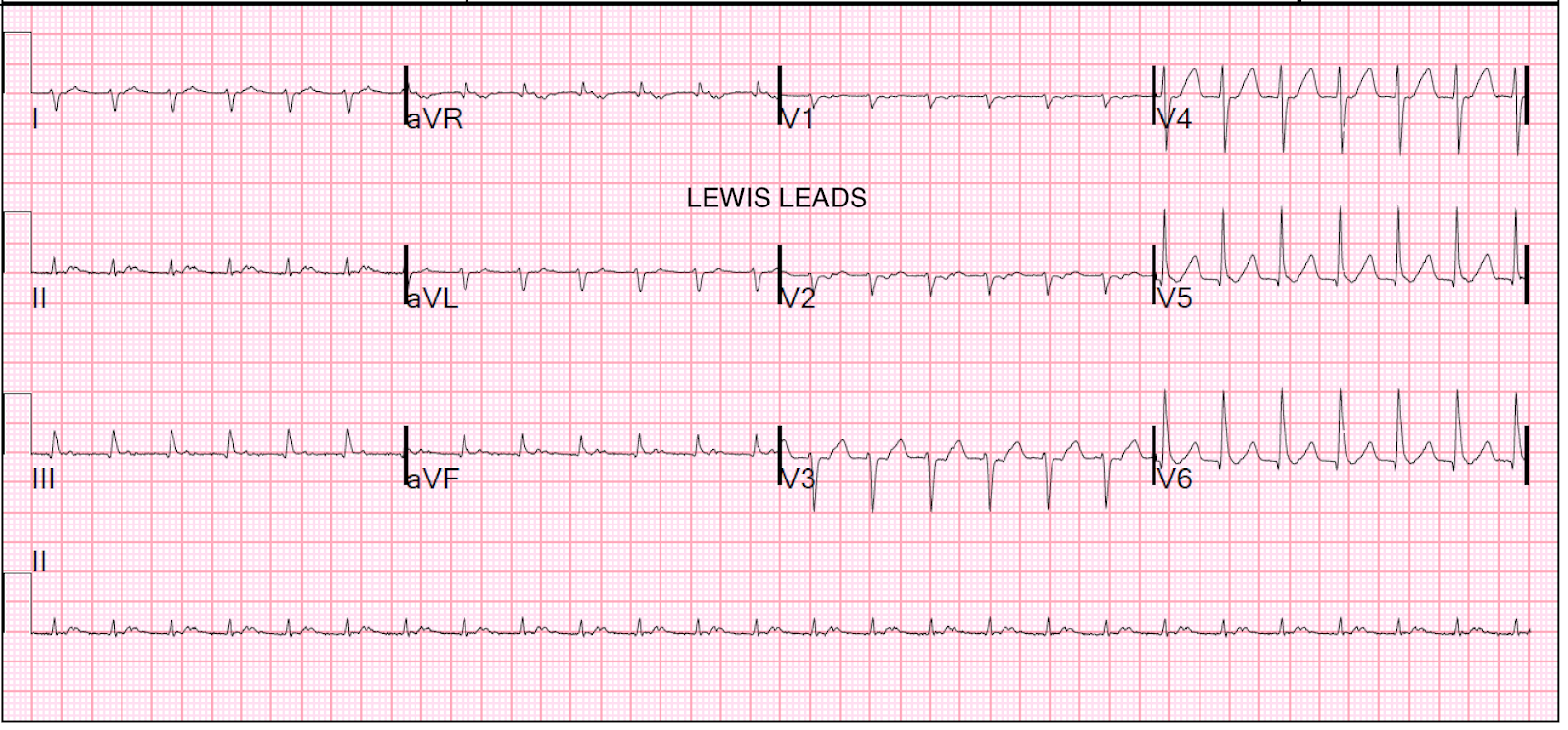 Dr. Smith's ECG Blog
