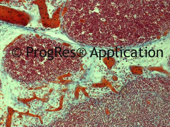 Microscope World Blog: Thymus and the Immune System