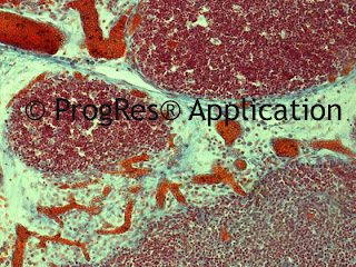 Microscope World Blog: Thymus and the Immune System