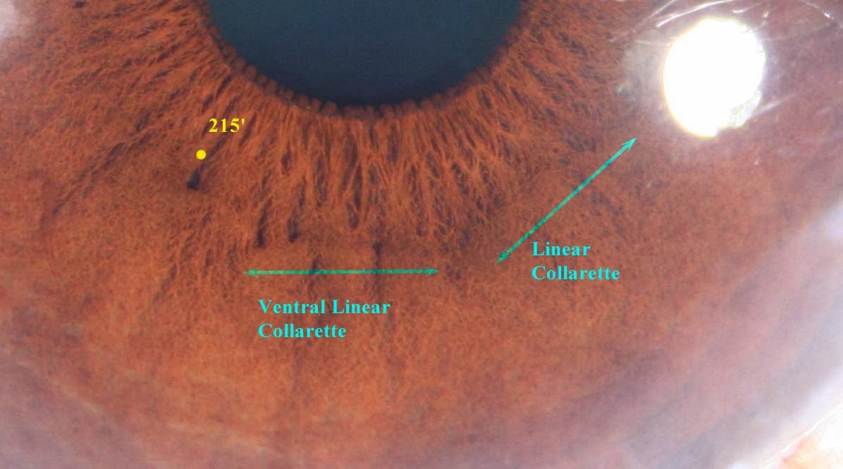 Modern & Multidimensional Iridology: Citric Acid Cycle Sign at 215' Vs ...