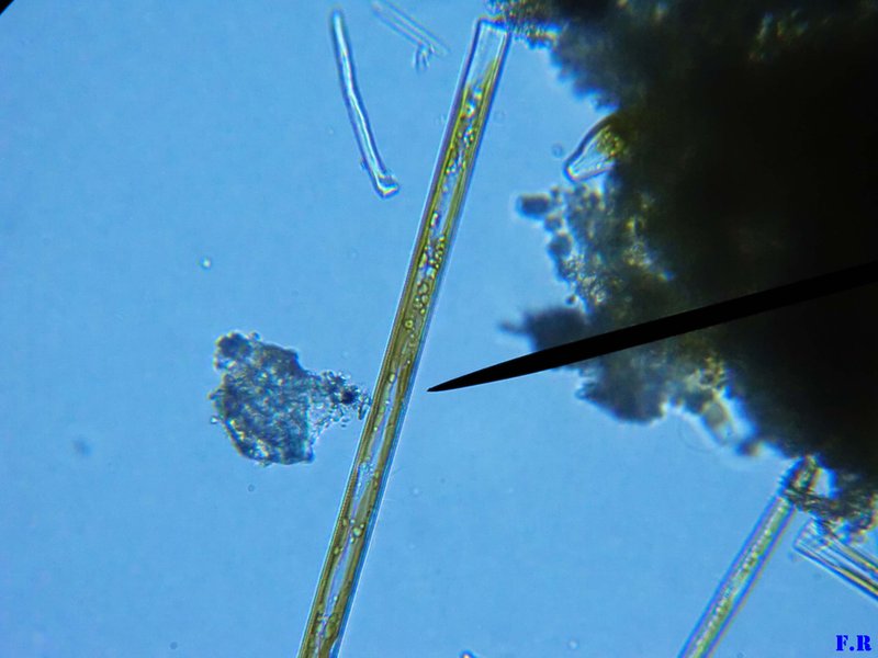 Microorganismo del agua.: SYNEDRA ULNA.
