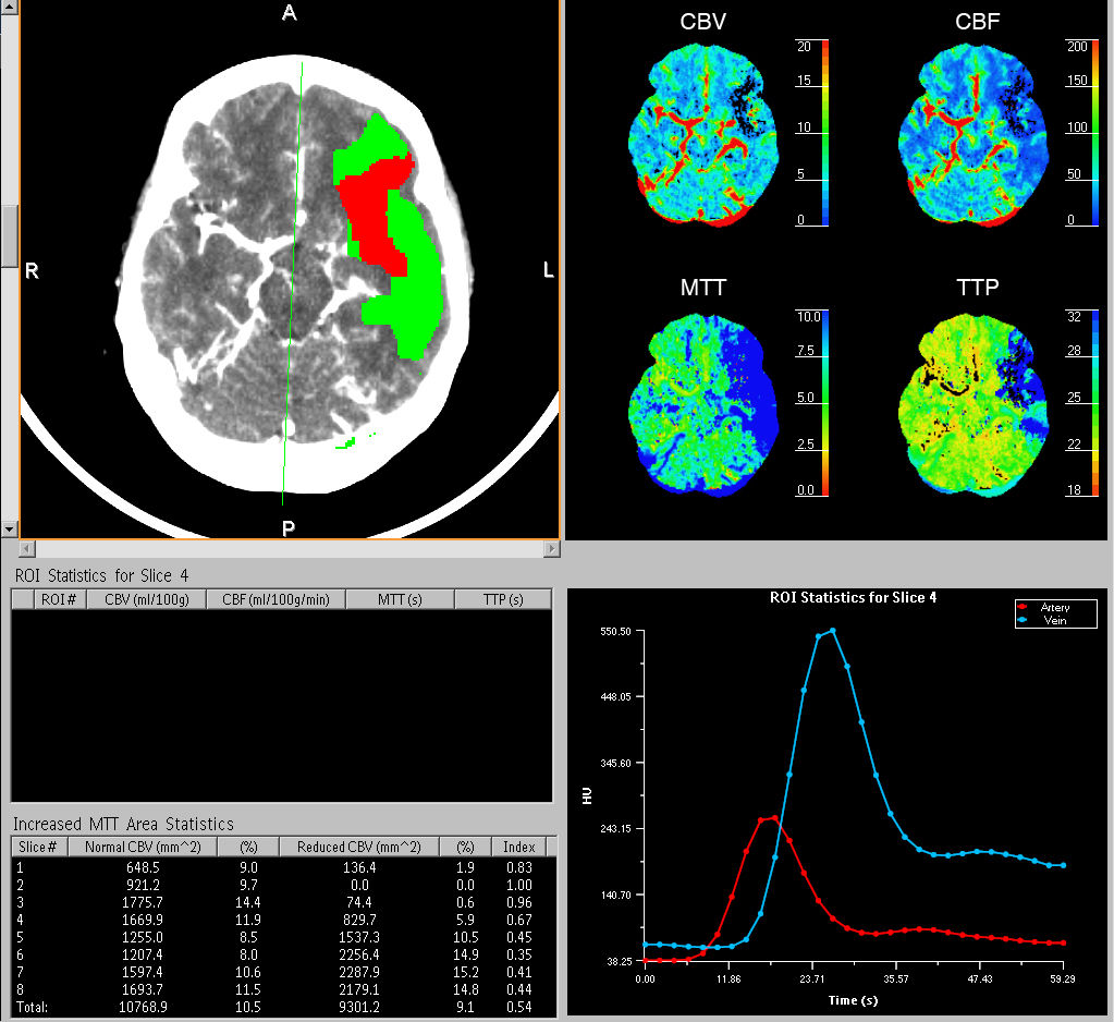 Resomag y su moderno Scanner Brillance CT