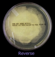 Fun With Microbiology (What's Buggin' You?): Apophysomyces elegans ...