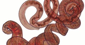 INFECTIOUS DISEASE: Introduction to helminths