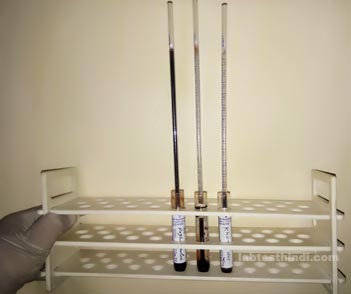 ESR Test कैसे लगाते हैं - latest Technique ~ Lab Test Hindi