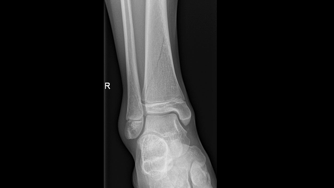 Casos de radiología de la Clínica Universidad de Navarra: CASO Nº199