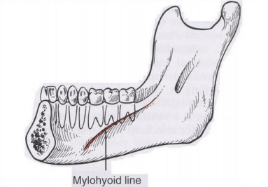 Oral Pathology Blog: Torus mandibularis and Ankyloglossia
