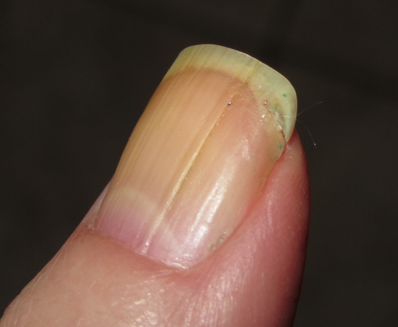 Marias Nail Art and Polish Blog: 1½ months of repairing a ripped/torn ...
