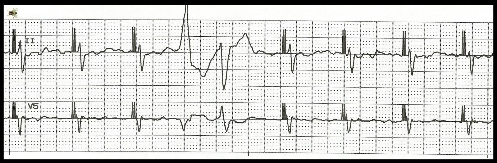 Float Nurse: September 2013