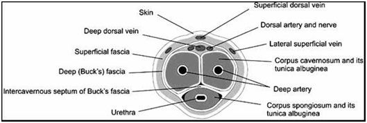 Dr Herry Setya Yudha Utama SpB. FInaCS. MHKes. ICS: Type of Hypospadia ...