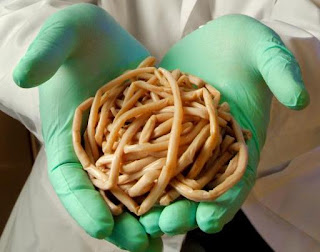 cacing cacing yang ada di perut manusia | berbagi info tips dan trick