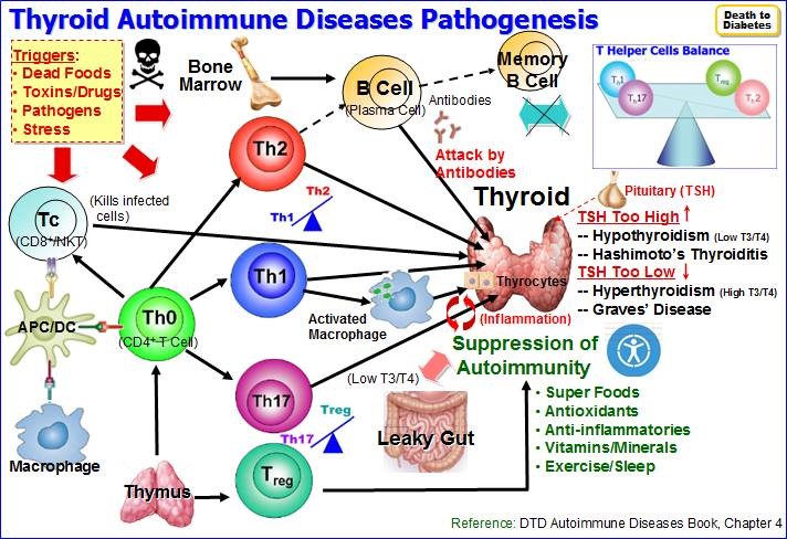 DISFUNÇÃO TIREOIDIANA SEM CONTROLE: A TIREOIDITE DE HASHIMOTO, TAMBÉM ...