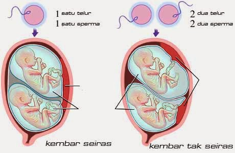 ♥Cik Rose Cute♥: Doa Dapatkan Anak Kembar