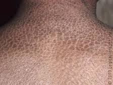 Medical Treatment Pictures-for Better Understanding: Acquired ...