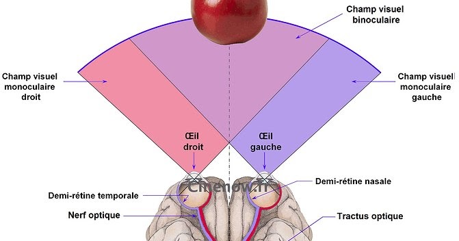 Chiasma Optique - Medecine & Maladie