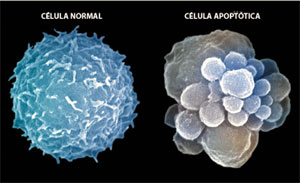 Patología Estructural y Funcional: Lesión y Muerte celular