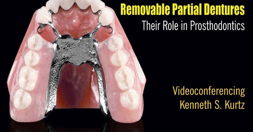 VIDEOCONFERENCING: Removable Partial Dentures - Their Role in ...