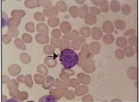 fichero hematologia: Basofilo