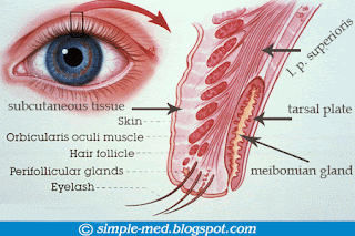 The Patient's Guide to Dry Eye Syndrome: Meibomian Gland Dysfunction ...